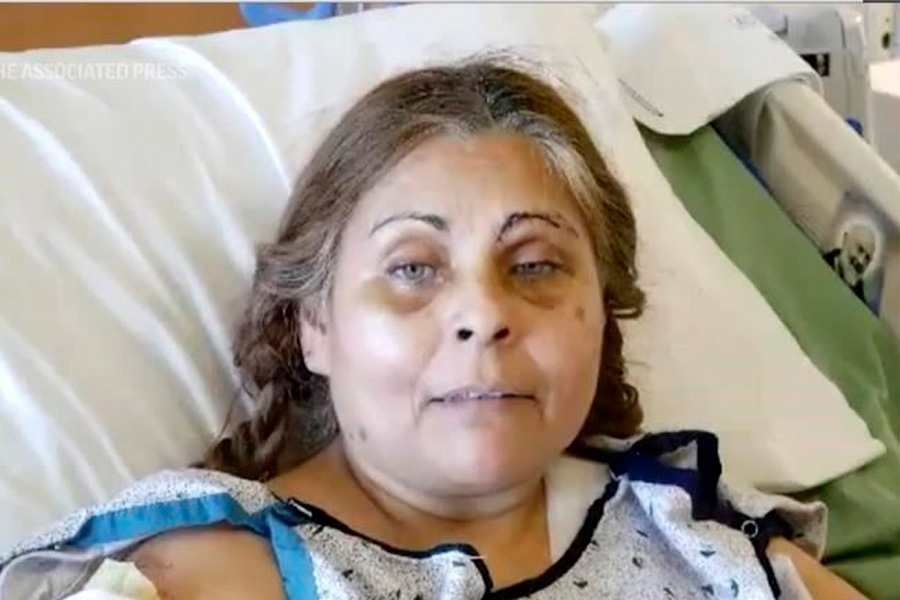 Factory explosion survivor, on fire, fell into chocolate vat - Impacto